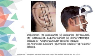 mikrotia : abnormalitas bentuk daun telinga | PDF
