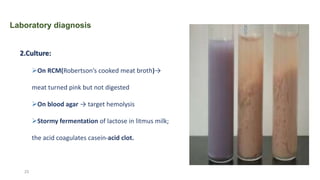 clostridium.perfringenes | PPTX