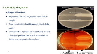 clostridium.perfringenes | PPTX