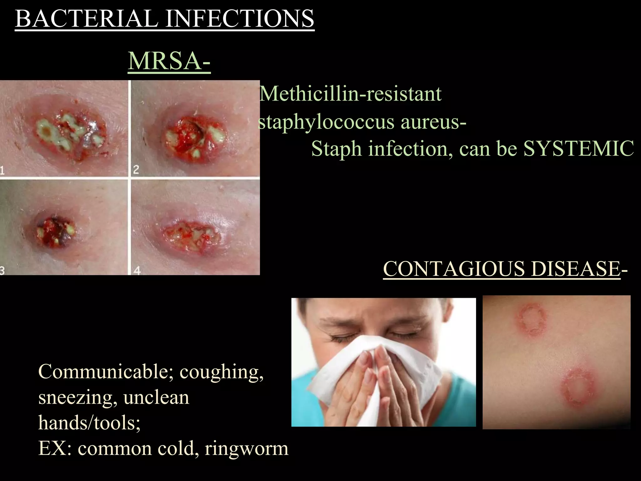 Milady infection control updated | PPTX