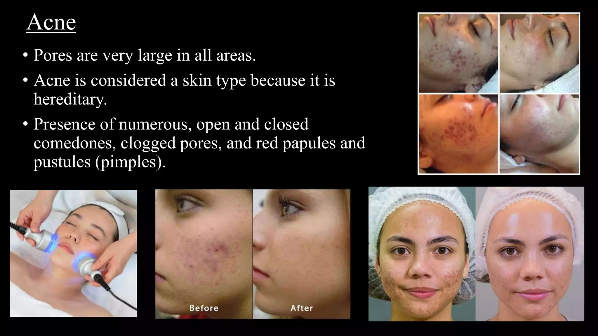 Milady facials | PPTX