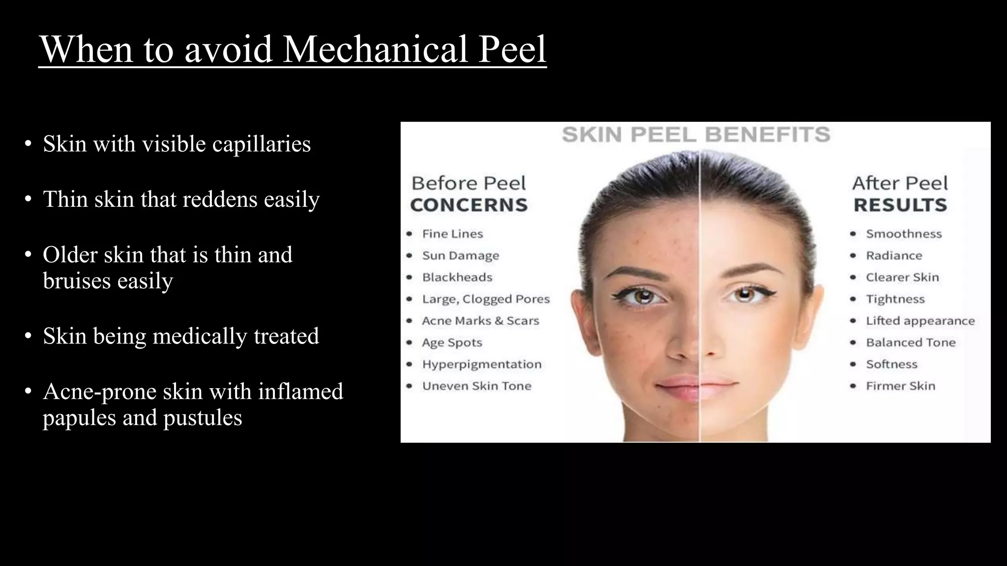 Milady facials | PPTX