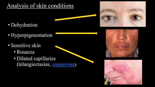 Milady facials | PPTX | Skin Care | Beauty