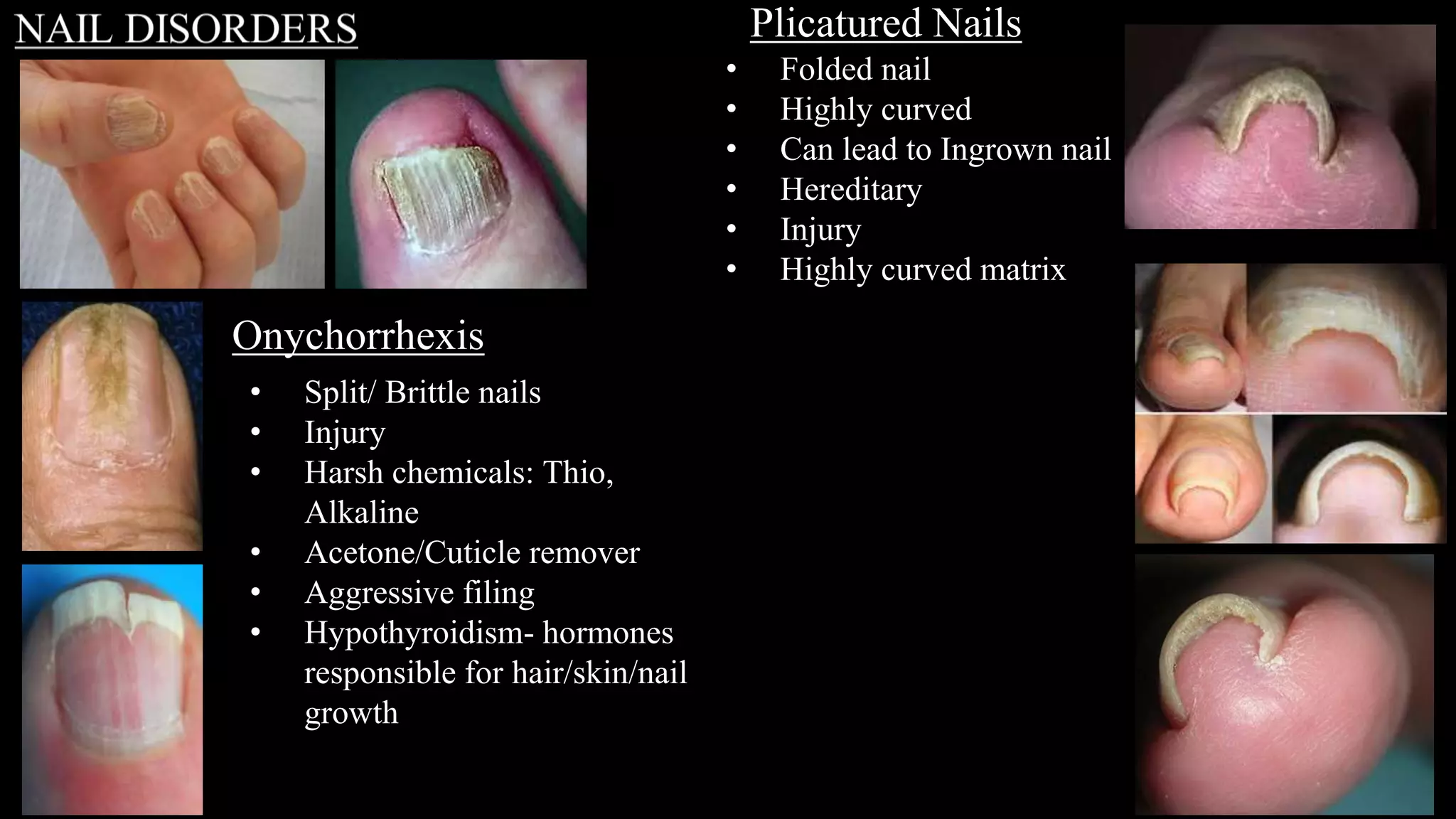 Milady nail disease & disorder | PPTX