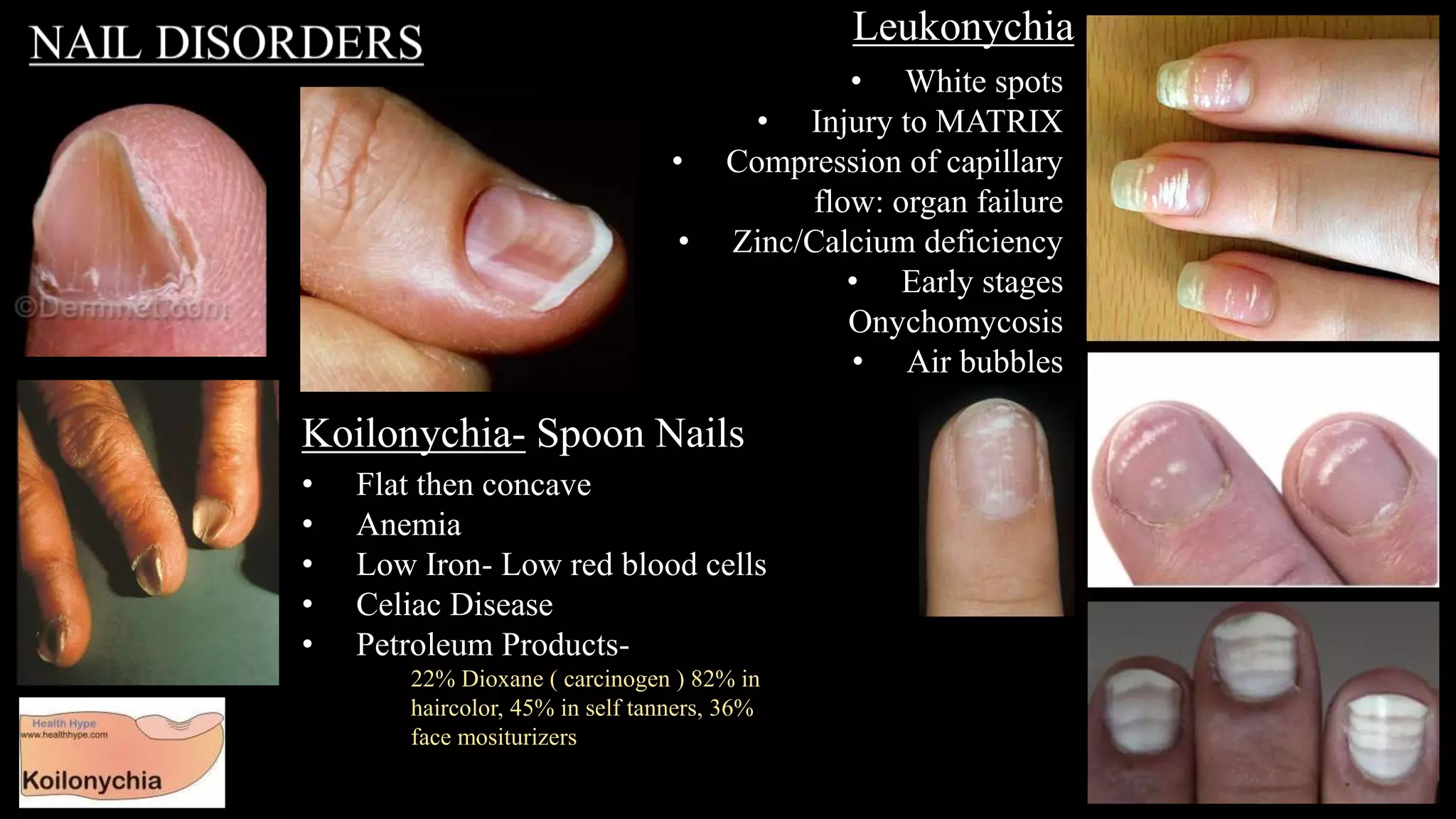 Milady nail disease & disorder | PPTX