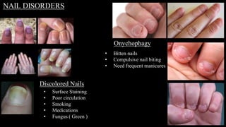 Milady nail disease & disorder | PPTX