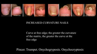 Milady nail disease & disorder | PPTX