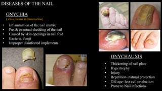 Milady nail disease & disorder | PPTX