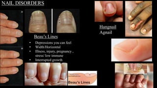 Milady nail disease & disorder | PPTX