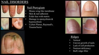 Milady nail disease & disorder | PPT