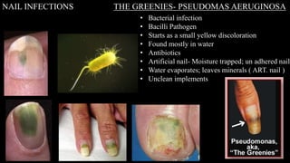Milady nail disease & disorder | PPT