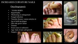 Milady nail disease and disorder Lecture | PPTX