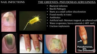 Milady nail disease and disorder Lecture | PPTX
