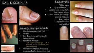 Milady nail disease and disorder Lecture | PPTX