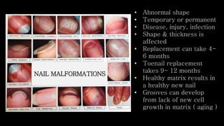 Milady nail structure | PPTX