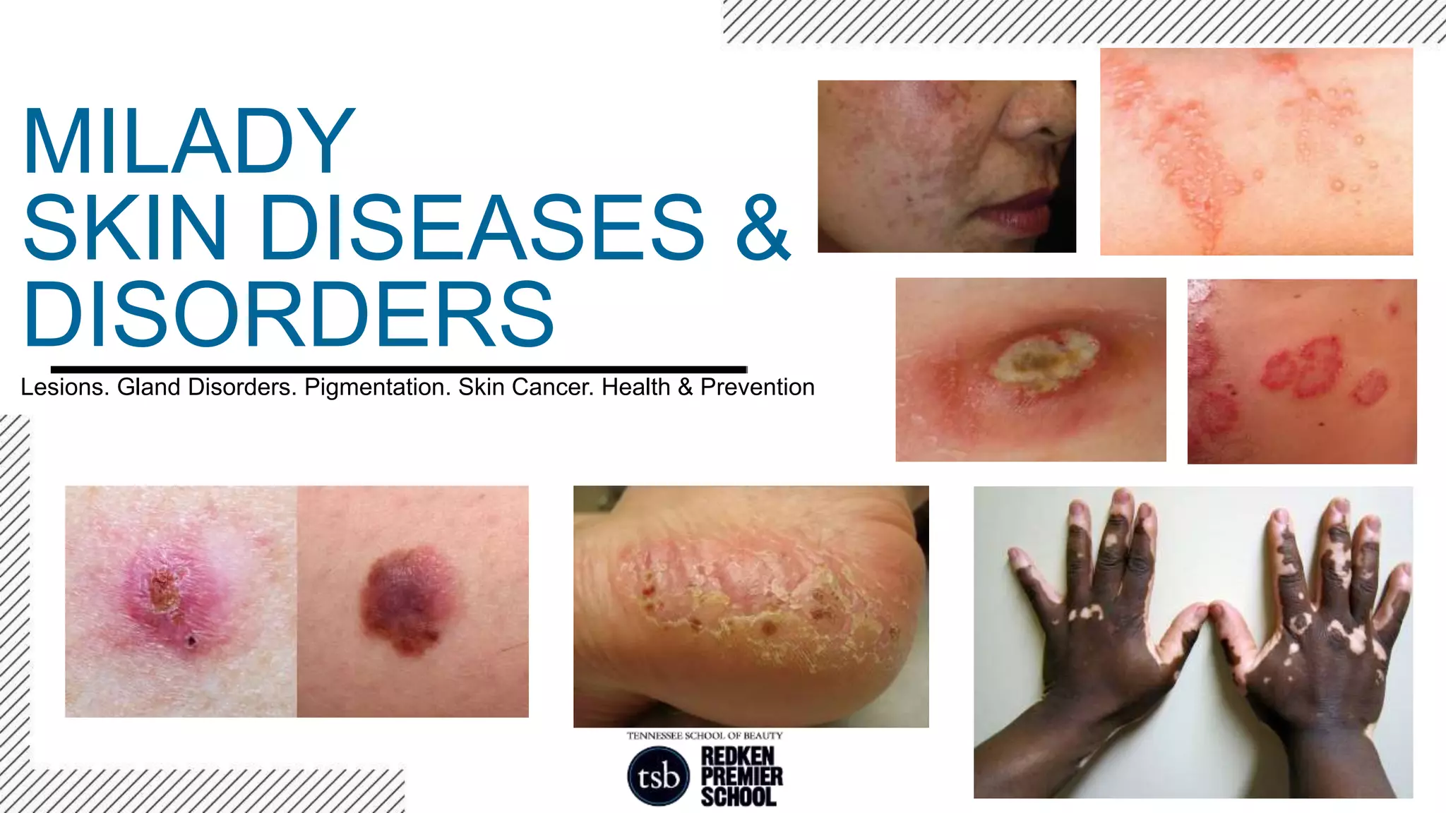 Milady skin diseases & disorders | PPTX
