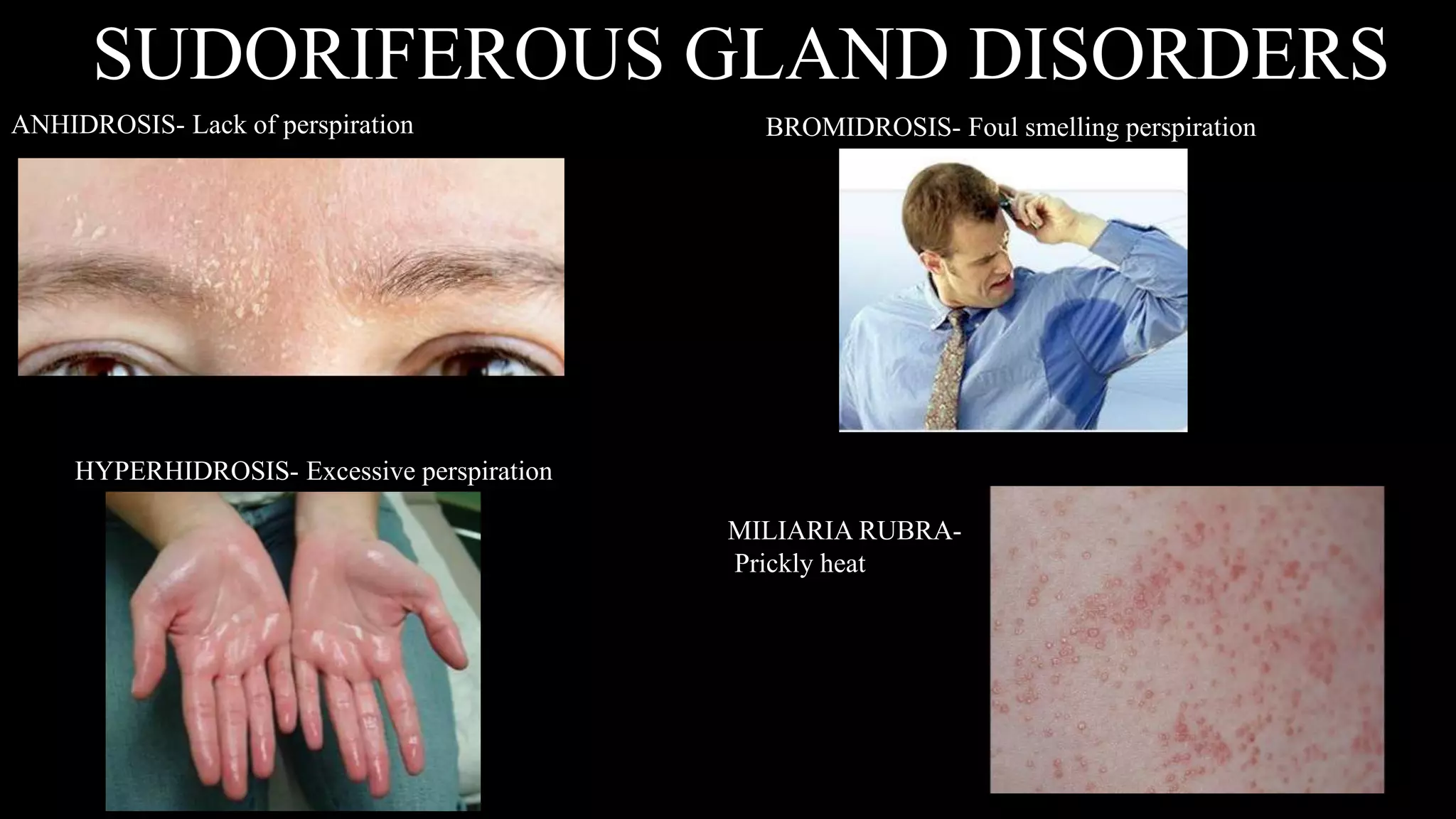Milady skin diseases & disorders | PPTX