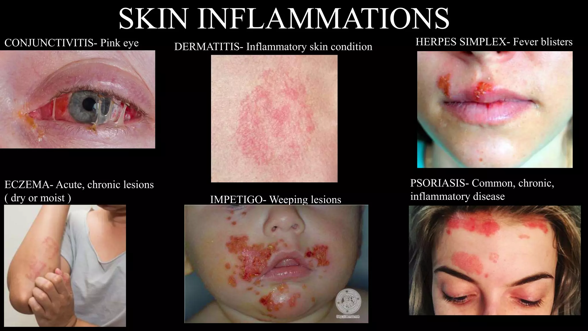 Milady skin diseases & disorders | PPTX