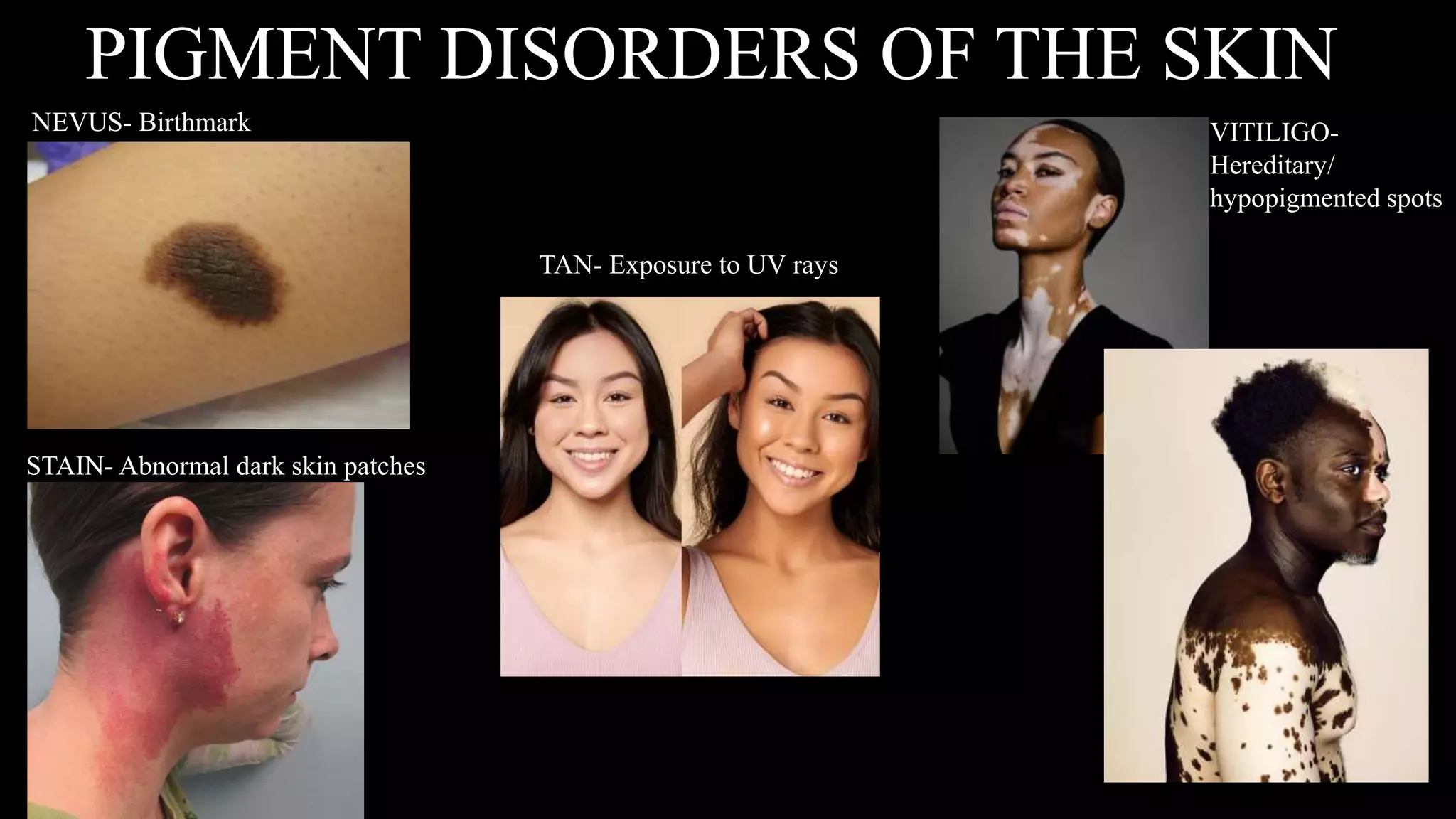 Milady skin diseases & disorders | PPTX