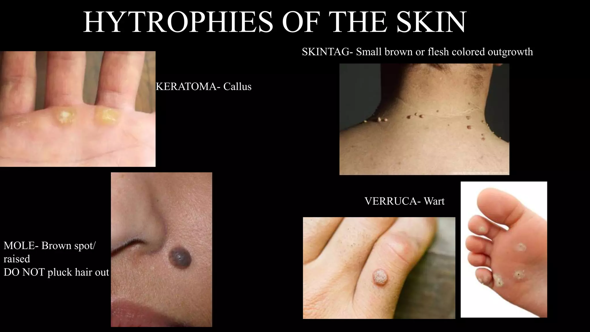 Milady skin diseases & disorders | PPTX