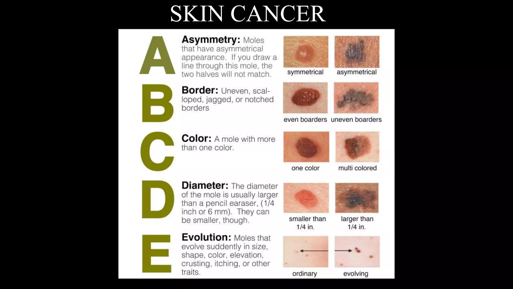 Milady skin diseases & disorders | PPTX