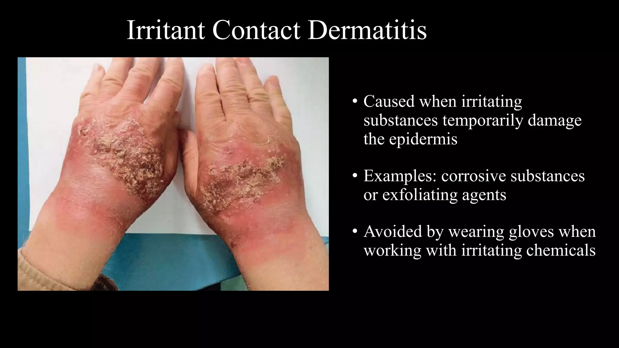 Milady skin diseases & disorders | PPTX