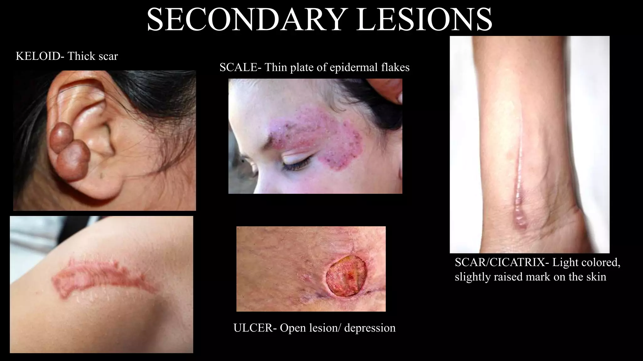 Milady skin diseases & disorders | PPTX