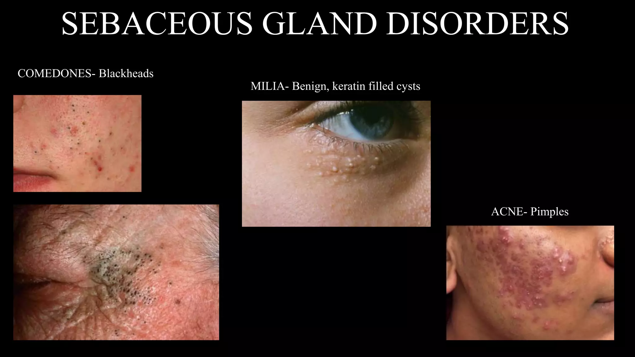 Milady skin diseases & disorders | PPTX