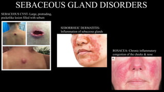 Milady skin diseases & disorders | PPTX