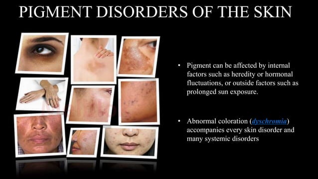 Milady skin diseases & disorders | PPTX | Skin and Dermatology ...
