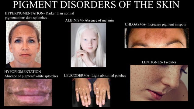 Milady skin diseases & disorders | PPTX | Skin and Dermatology ...