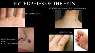 Milady skin diseases & disorders | PPTX