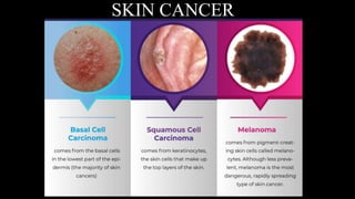 Milady skin diseases & disorders | PPTX | Skin and Dermatology | Diseases and Conditions