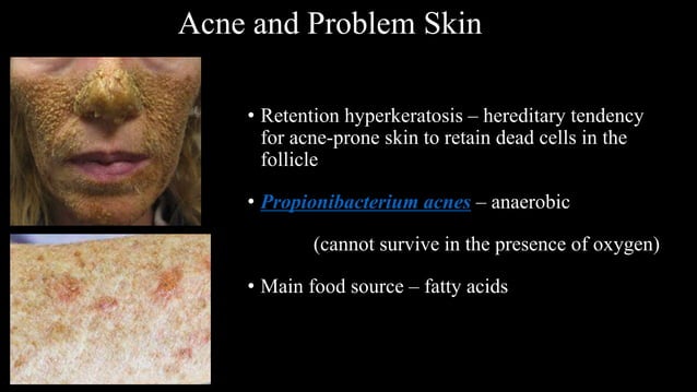 Milady skin diseases & disorders | PPTX | Skin and Dermatology ...