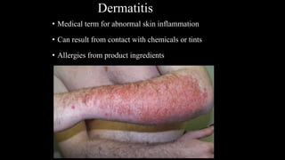 Milady skin diseases & disorders | PPTX
