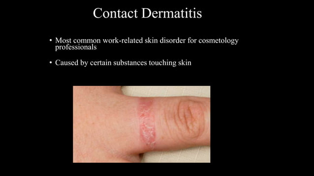 Milady skin diseases & disorders | PPTX | Skin and Dermatology ...