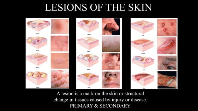 Milady skin diseases & disorders | PPTX | Skin and Dermatology ...