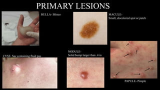 Milady skin diseases & disorders | PPTX