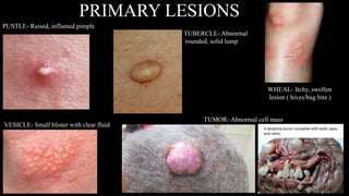 Milady skin diseases & disorders | PPTX
