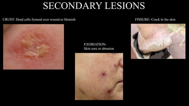 Milady skin diseases & disorders | PPTX | Skin and Dermatology ...