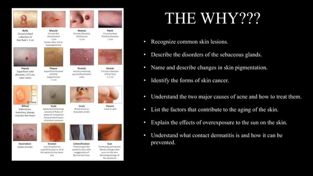 Milady skin diseases & disorders