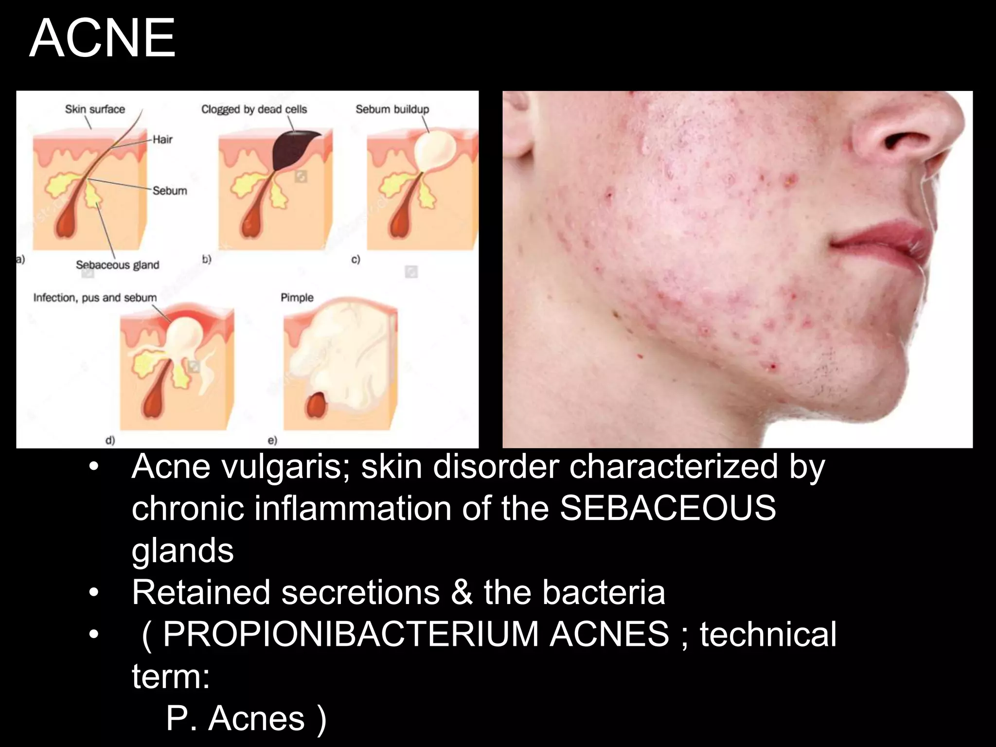 Milady skin structure, growth, nutrition | PPTX