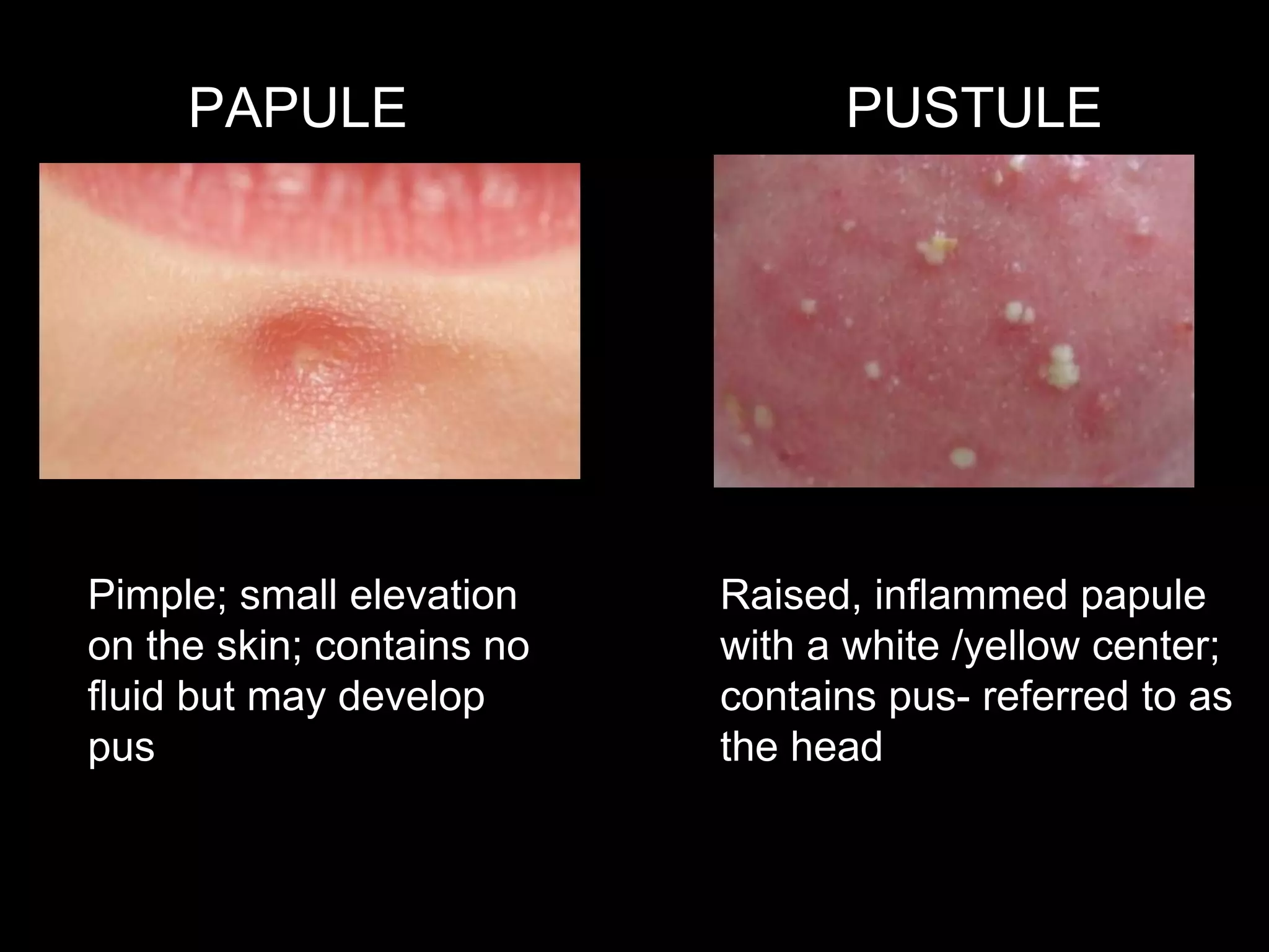 Milady skin structure, growth, nutrition | PPTX