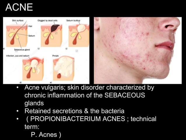 Milady skin structure, growth, nutrition | PPTX