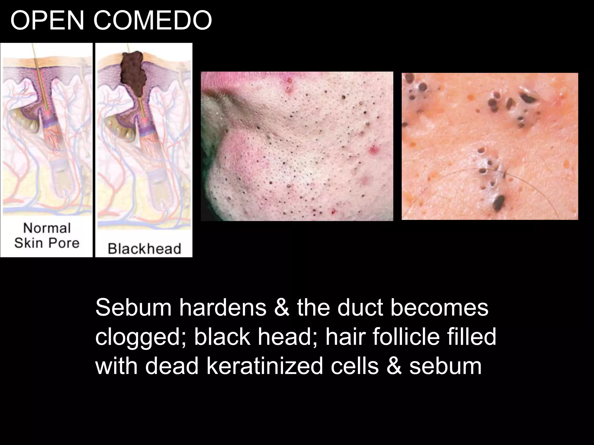 Milady skin structure, growth and nutrition | PPTX