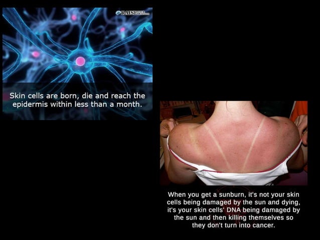 Milady Ch7 Skin Structure, Growth, Nutrition UPDATED | PPTX | Skin and ...