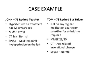 Mild Cognitive Imparement | PPT