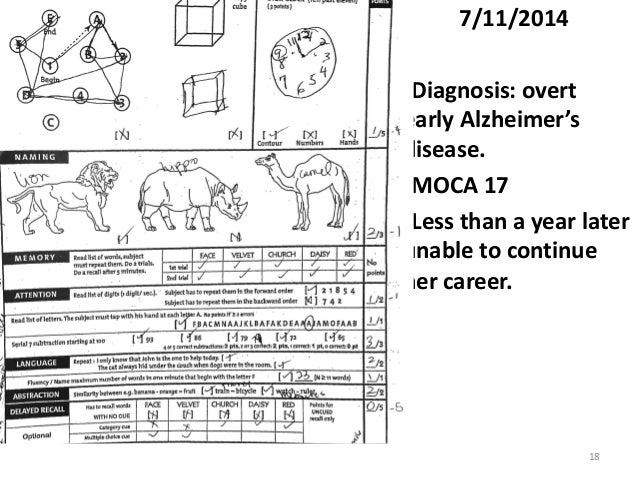 Mild cognitive impairment
