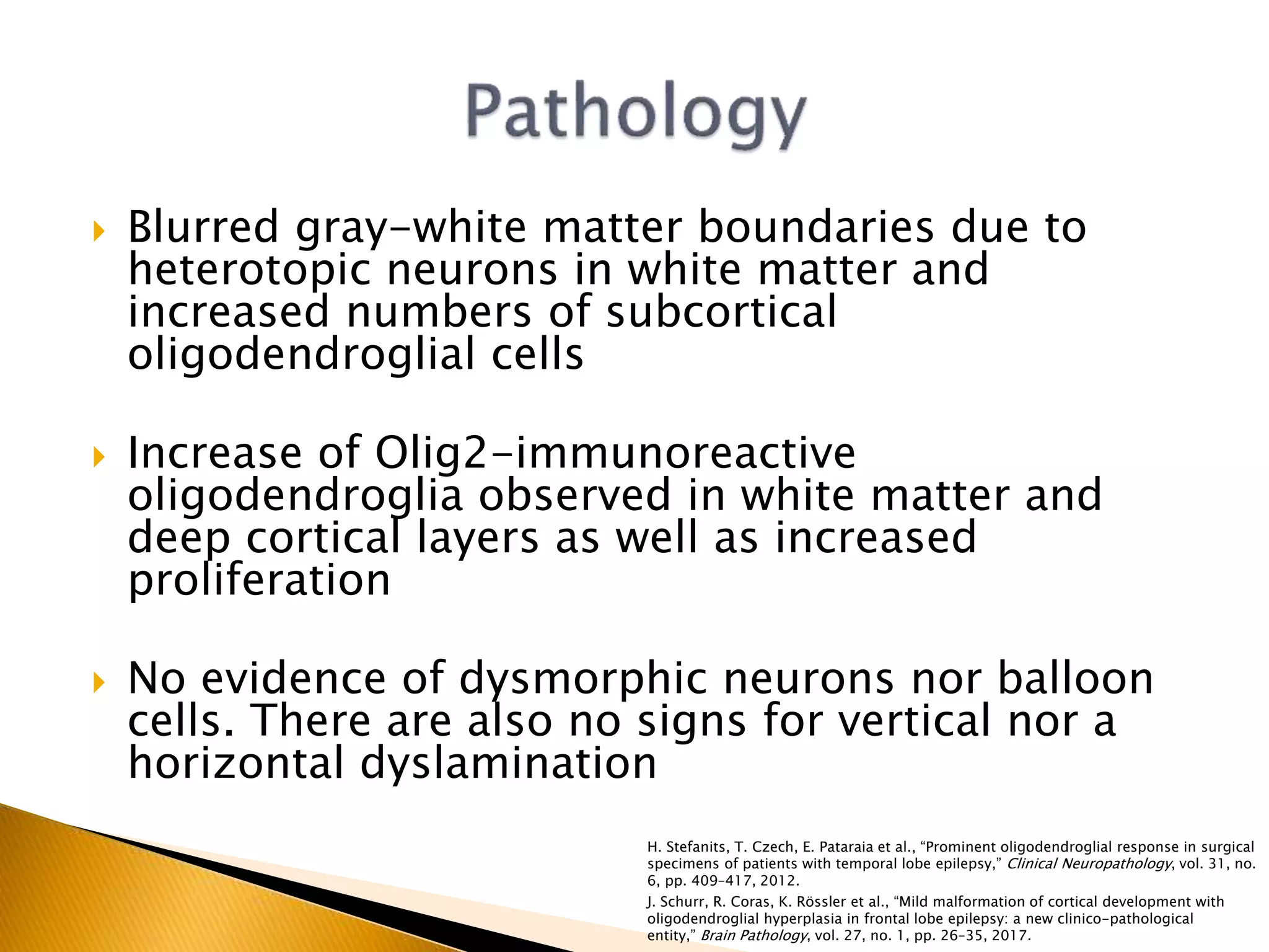 Mild Malformation of Cortical Development with Oligodendroglial ...