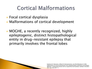 Mild Malformation of Cortical Development with Oligodendroglial ...